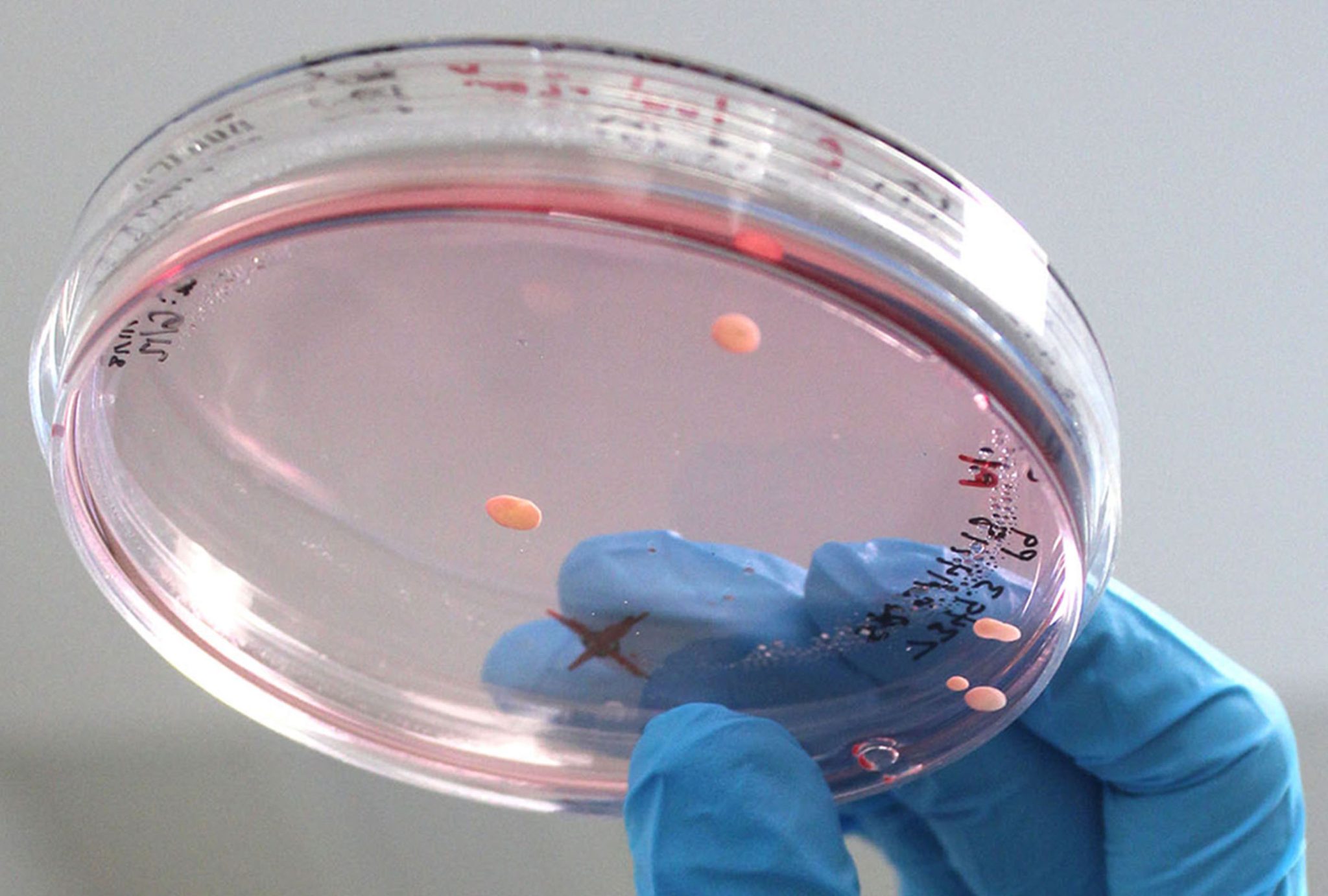 Brain-like organoids grown in a dish provide window into autism – @theU