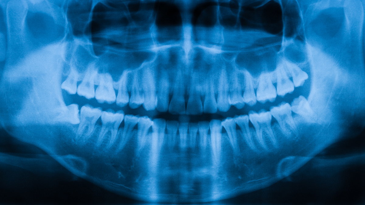 The history recorded in your teeth – @theU
