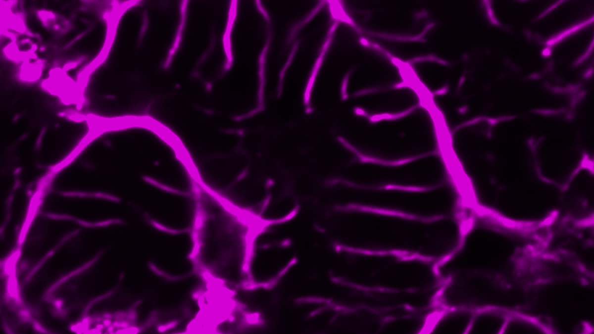 New gene therapy reverses heart failure in large animal model – @theU