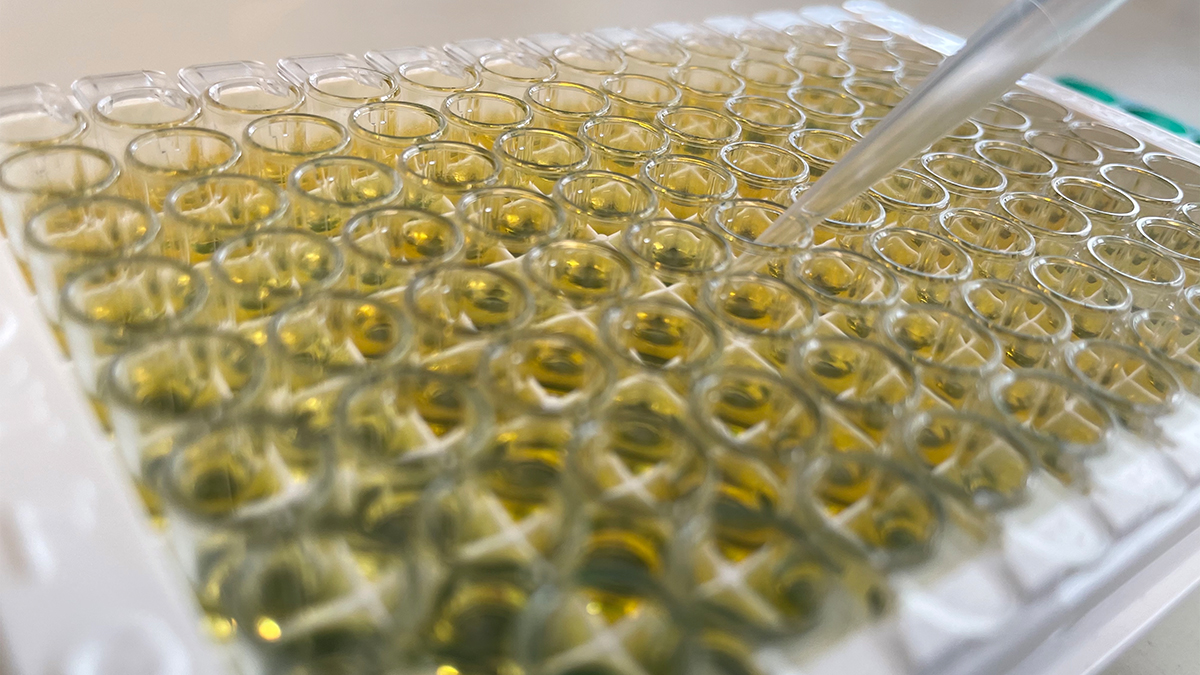 Research uncovers why IBD causes blood clots – @theU