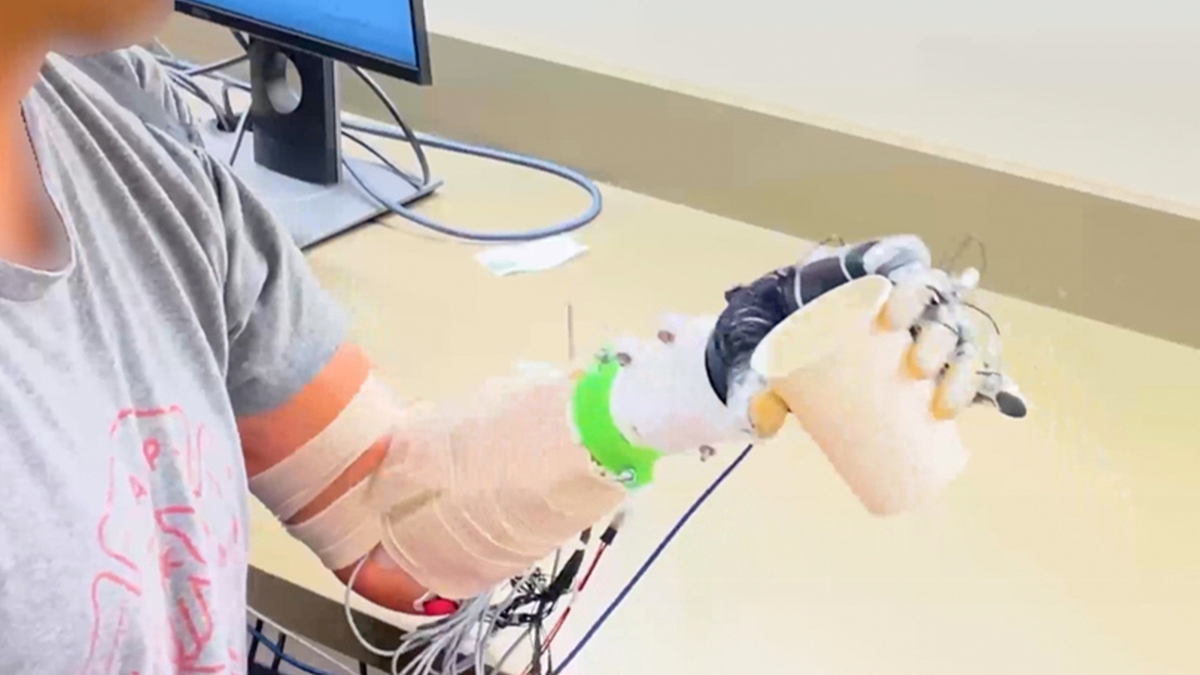 U engineers give a bionic hand a mind of its own – @theU